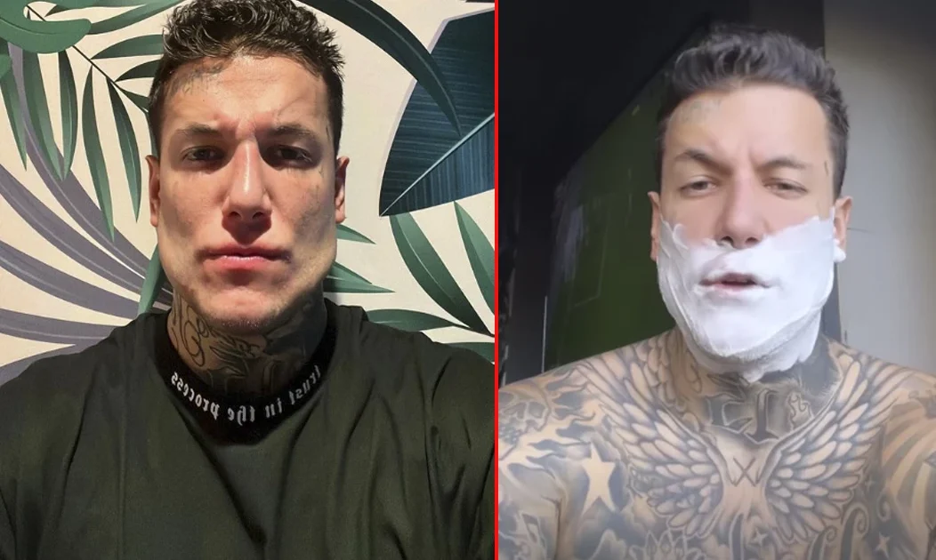 El video de Alex Caniggia mostrando su nueva cara tras operarse: “Cada ...