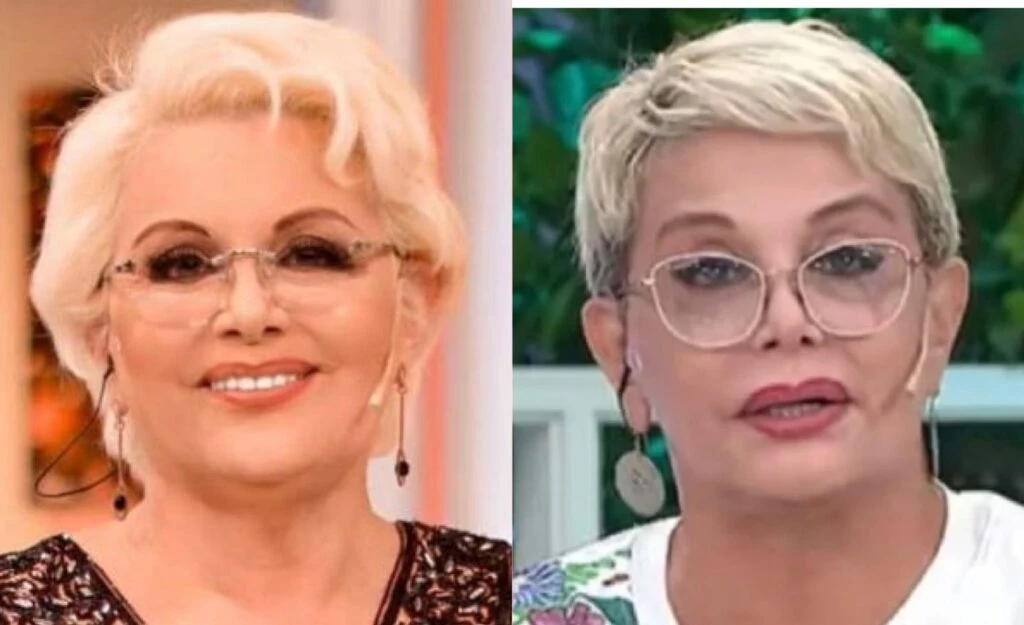 El drama capilar que atraviesa Carmen Barbieri: “Le dio mucho a la ...