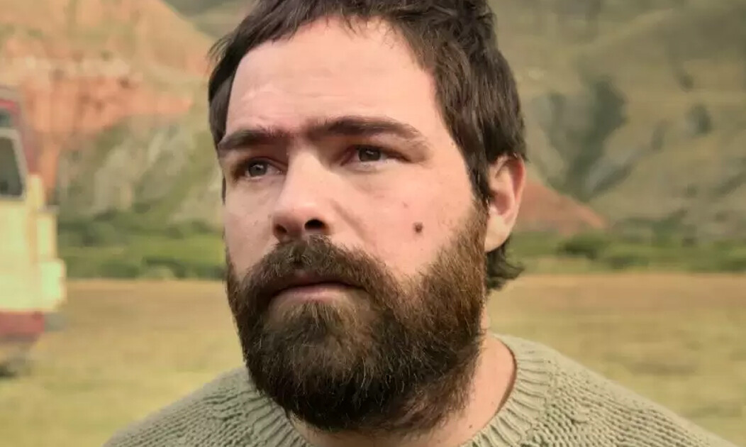 Así quedó Peter Lanzani luego de superar una complicada operacion: la ...